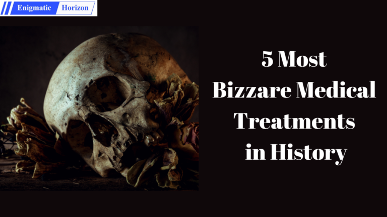 5 Most Bizarre Medical Treatments and Practices in History - Enigmatic ...